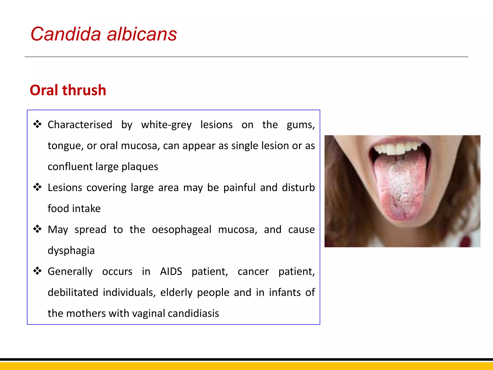 Candida albicans | PPTX