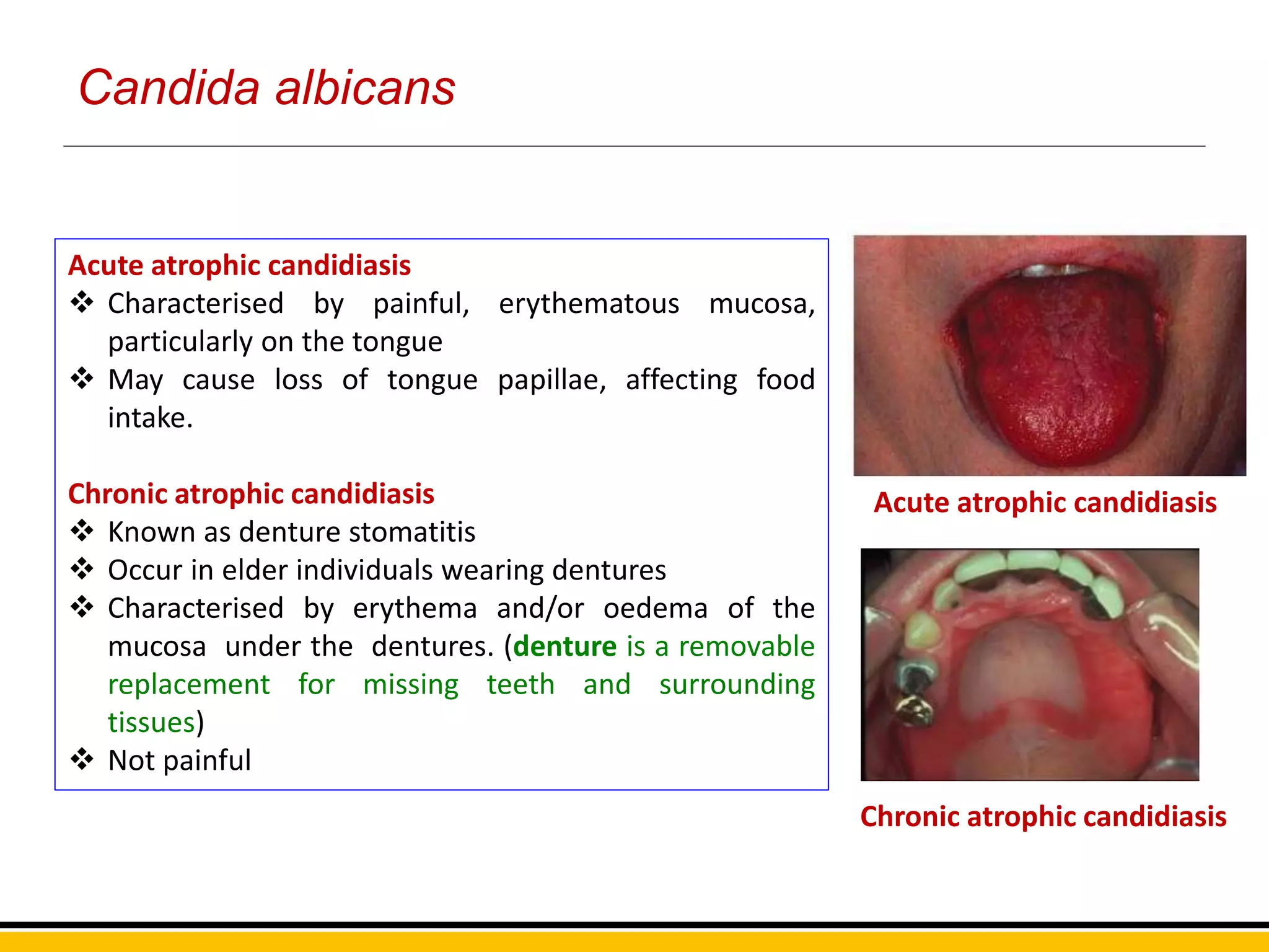 Candida albicans | PPTX