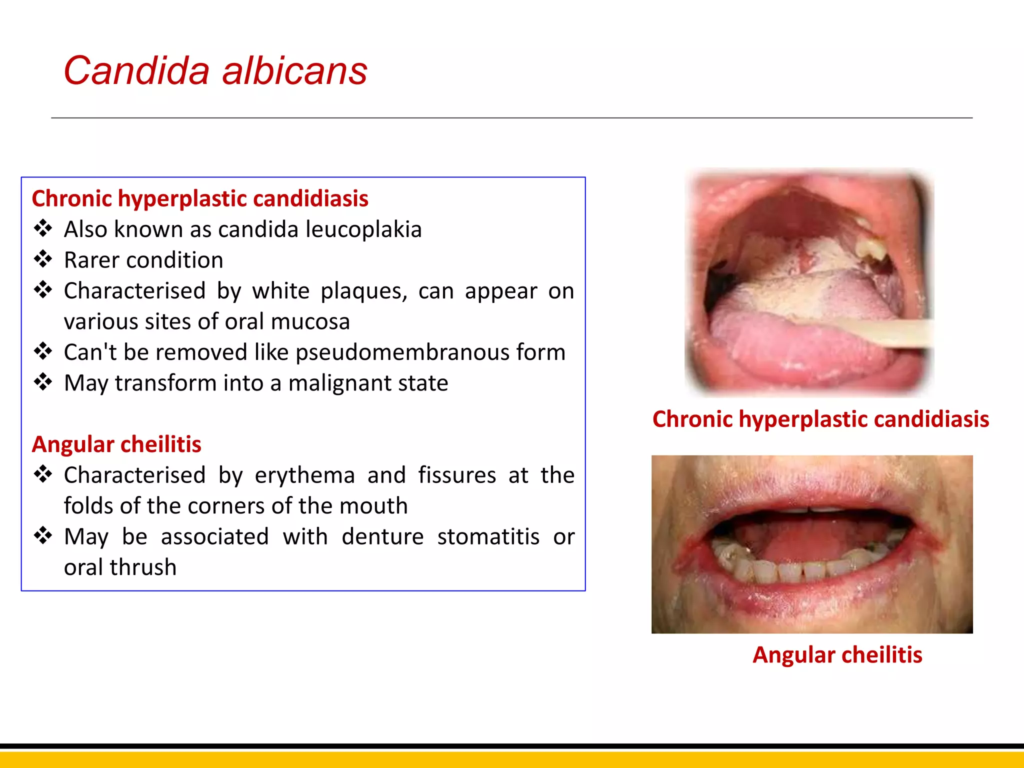 Candida albicans | PPTX
