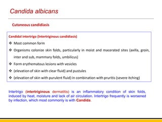 Candida albicans | PPTX