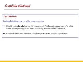 Candida albicans | PPTX
