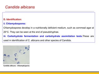 Candida albicans | PPTX