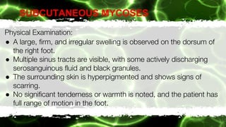 Mycology 2025 Subcutaneous Mycoses infections 1.pdf