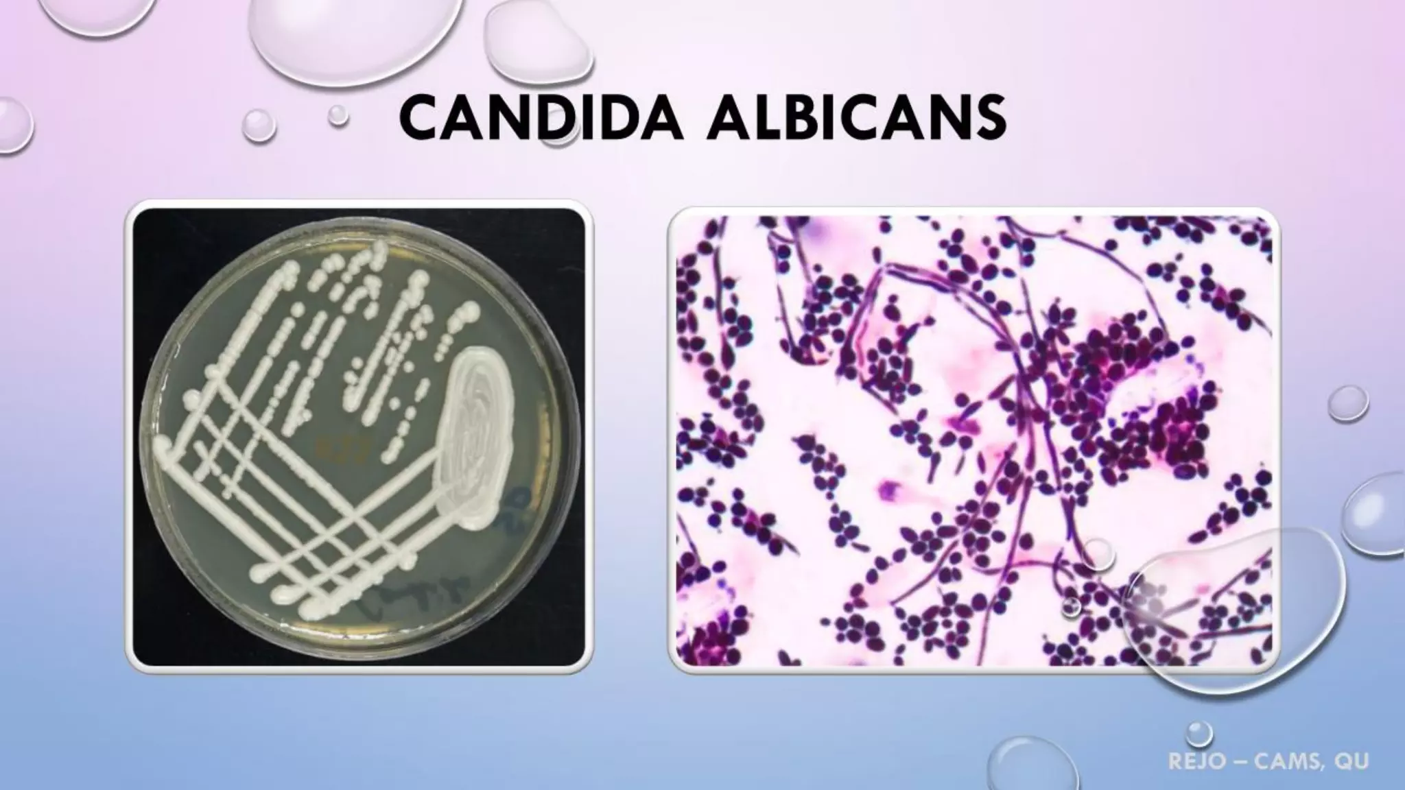 Mycology colony morphology & Microscopy- Part 1 | PDF