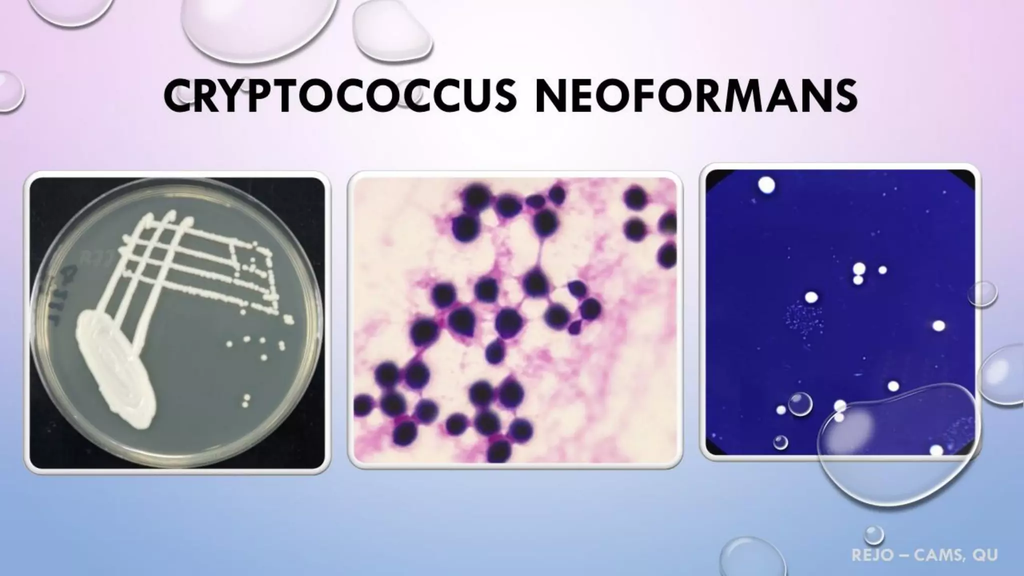 Mycology colony morphology & Microscopy- Part 1 | PDF