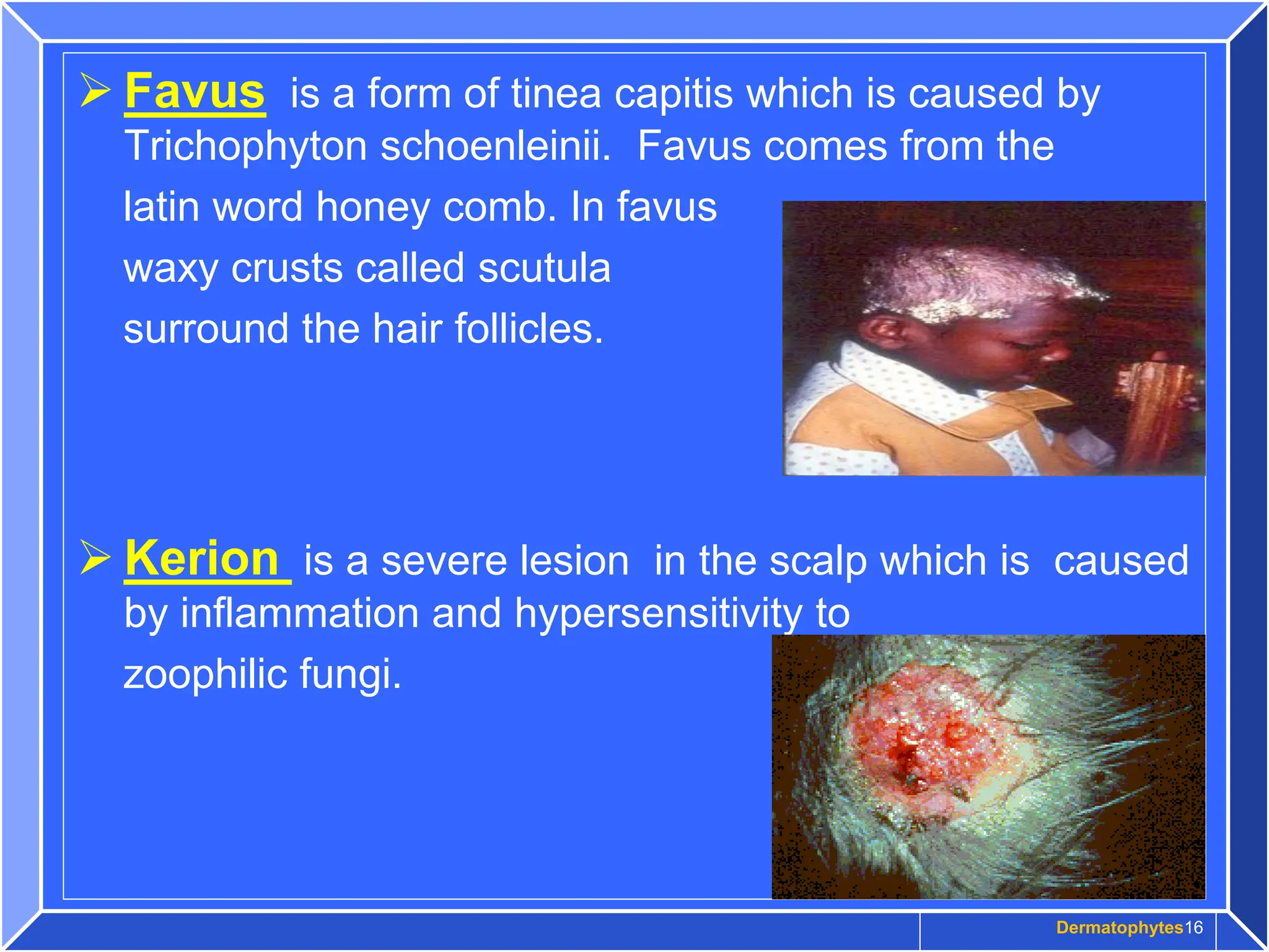 Mycology Lec.4.pdf medically important fungal | PDF