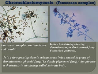 Histopathological Diagnosis of Fungal Infections of 21st century | PPT
