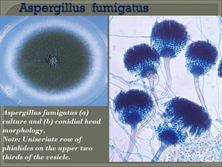 Histopathological Diagnosis of Fungal Infections of 21st century | PPT