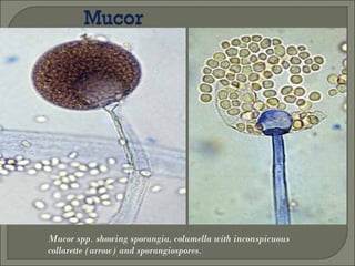 Histopathological Diagnosis of Fungal Infections of 21st century | PPT