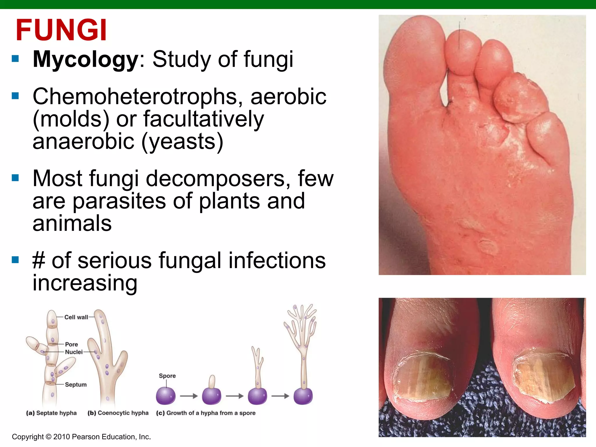 Mycology ,diseases caused by fungi | PPT