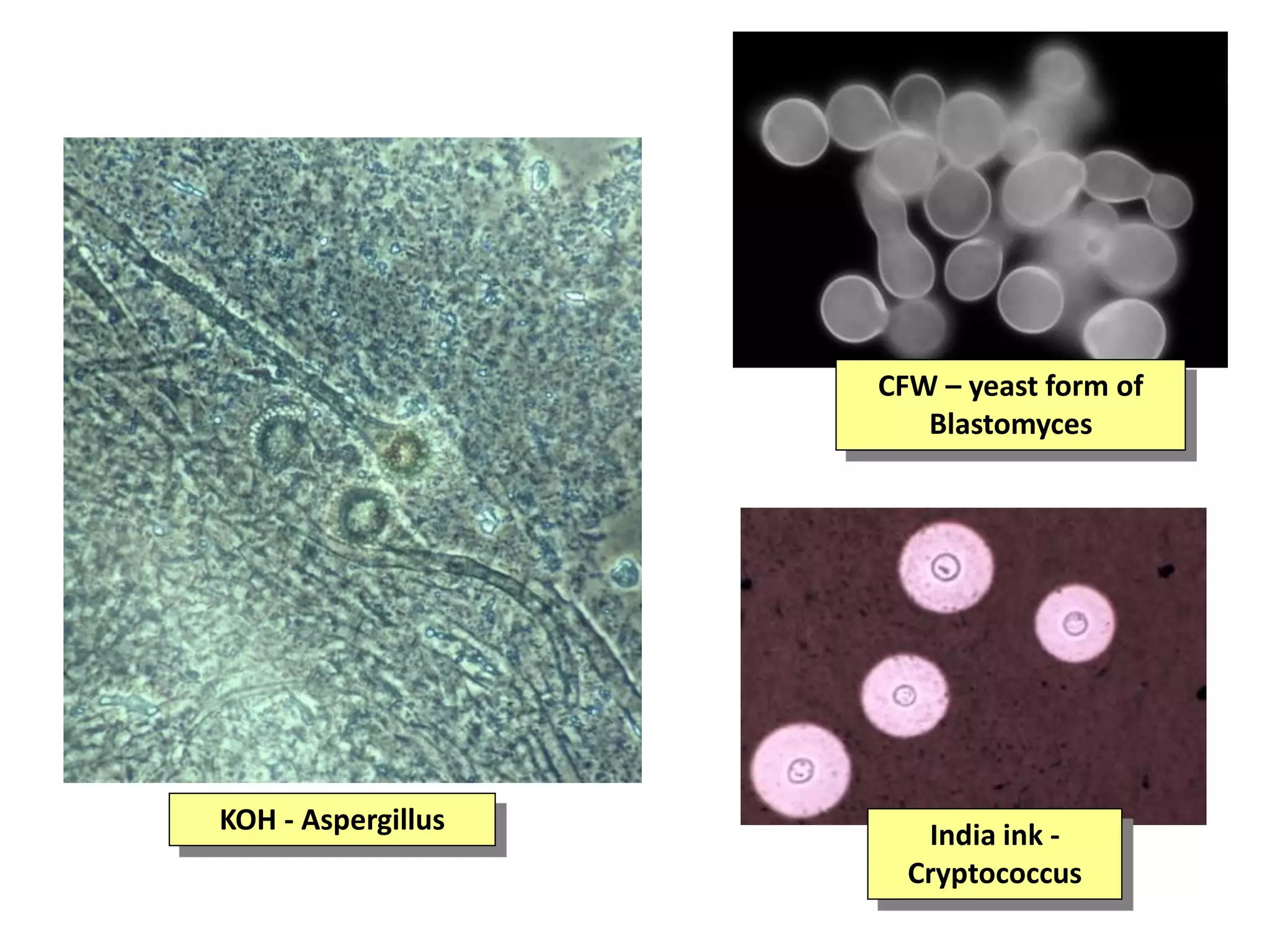 Mycology ppt ii laboratoy techniques for isolation and identification of fungi | PDF