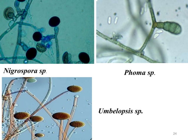 Mycology slides. | PPTX | Biological Sciences | Science