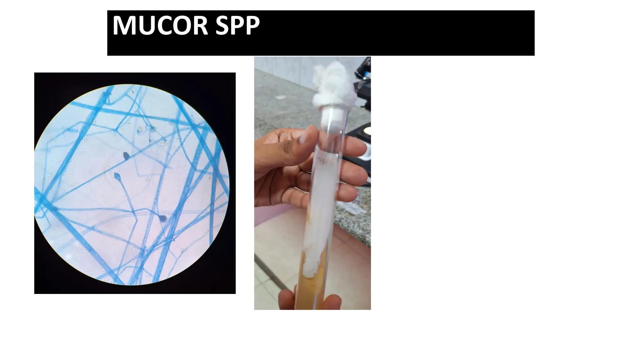MYCOLOGY SPT MICROBIOLOGY for dental students | PPTX