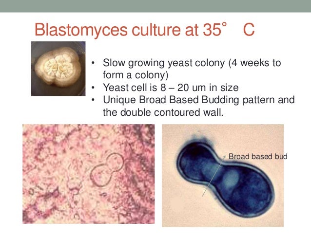 Mycology Update 2017