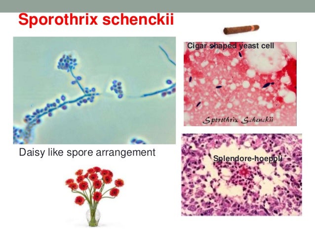 Mycology Update 2017