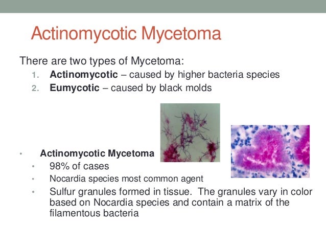 Mycology Update 2017