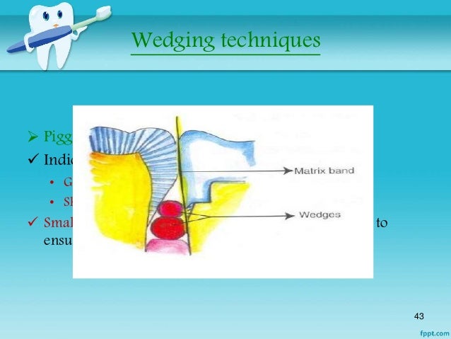 Contacts and Contours By Dr.Ruchir Kapur