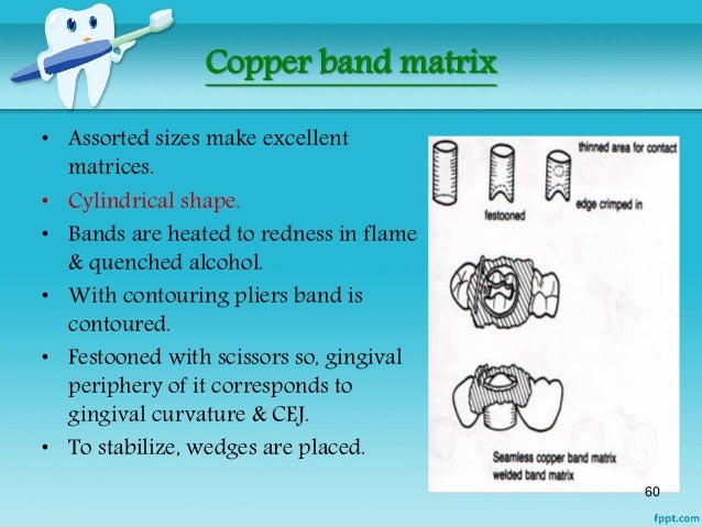 Contacts and Contours By Dr.Ruchir Kapur