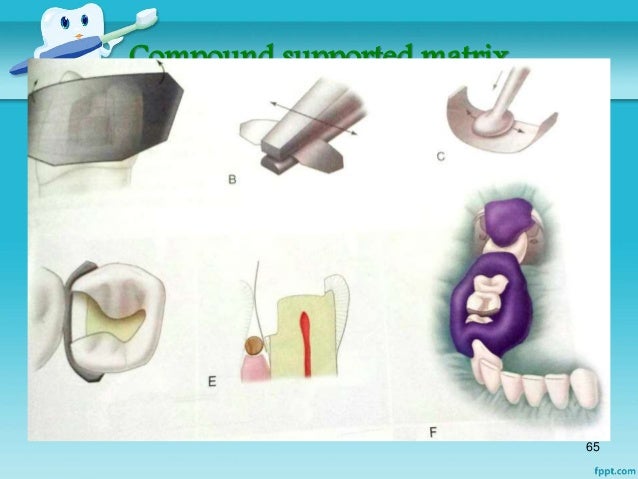 Contacts and Contours By Dr.Ruchir Kapur
