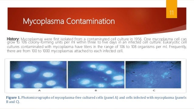 Mycoplasma contamination of cell cultures