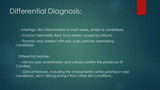 MYCOSES OF SMOOTH SKIN Mycoses of smooth skin (microsporia ...