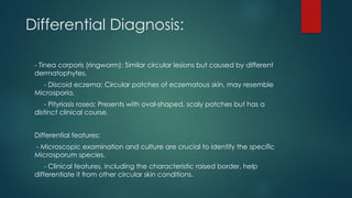 MYCOSES OF SMOOTH SKIN Mycoses of smooth skin (microsporia ...