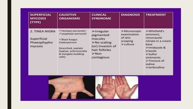 Mycosis-fungal diseases and basic information | PPT