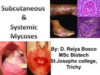subcutaneous Mycosis & systemic mycosis | PPTX