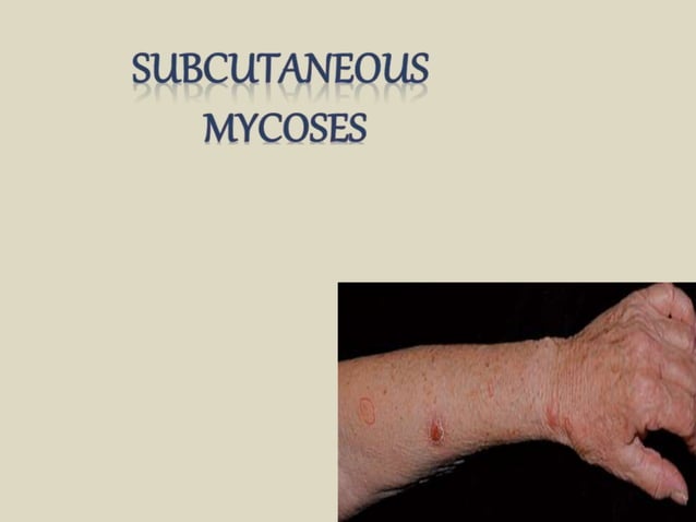 subcutaneous Mycosis & systemic mycosis | PPTX