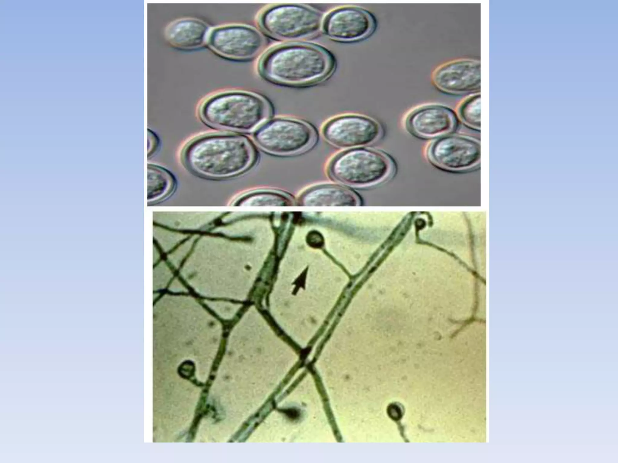 Mycotic(fungal) Infections | PPTX