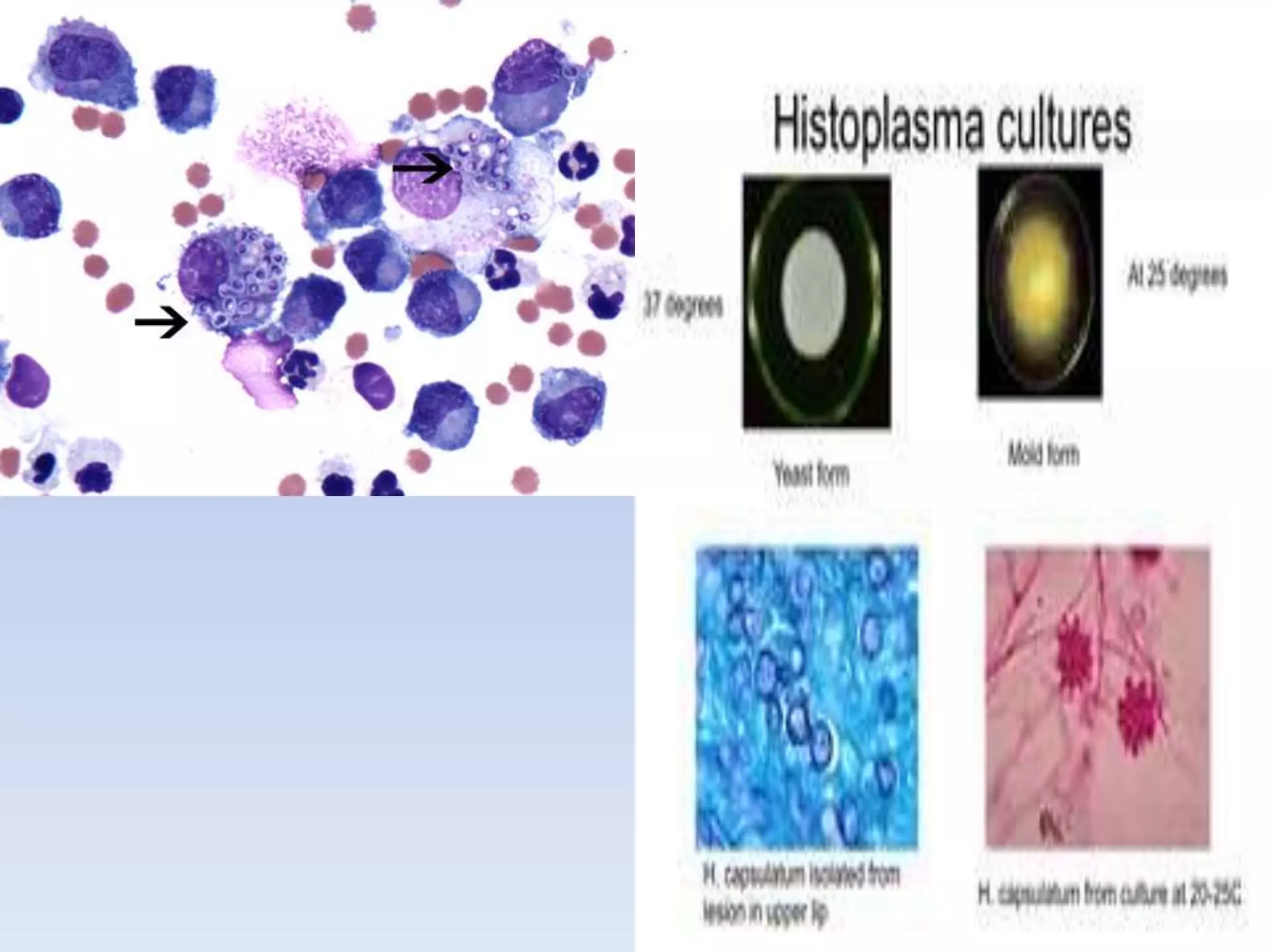Mycotic(fungal) Infections | PPTX