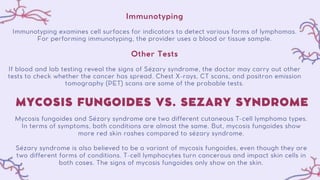 What Is Mycosis Fungoides Sezary Syndrome? | PPTX