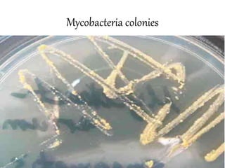 Mycobacterium tuberculosis | PPT