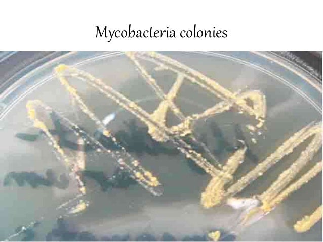 Mycobacterium tuberculosis