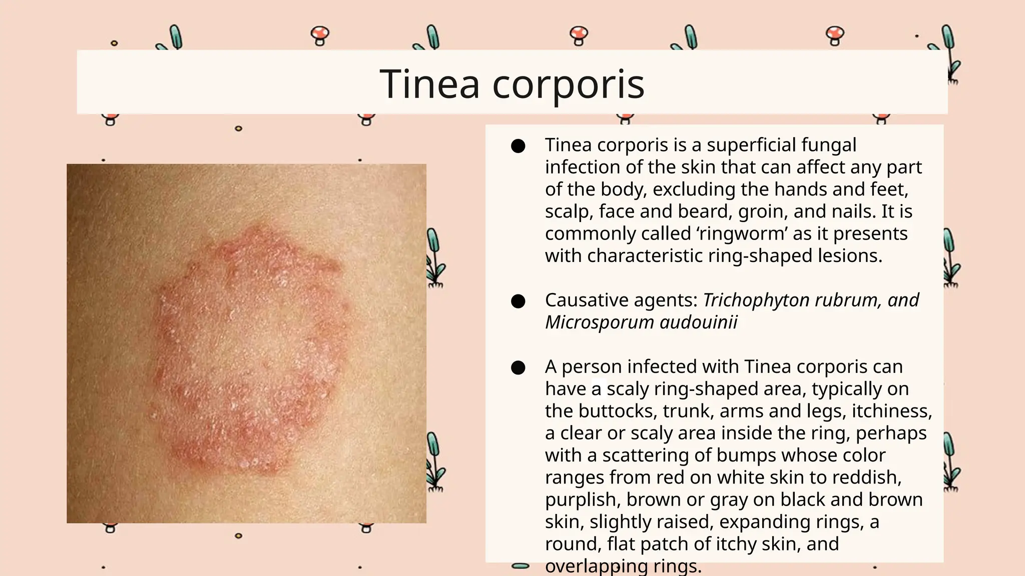 Mycotic Diseases Microbiology Powerpoint | PPTX