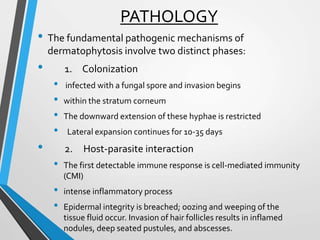 Mycotic Infections.ppt