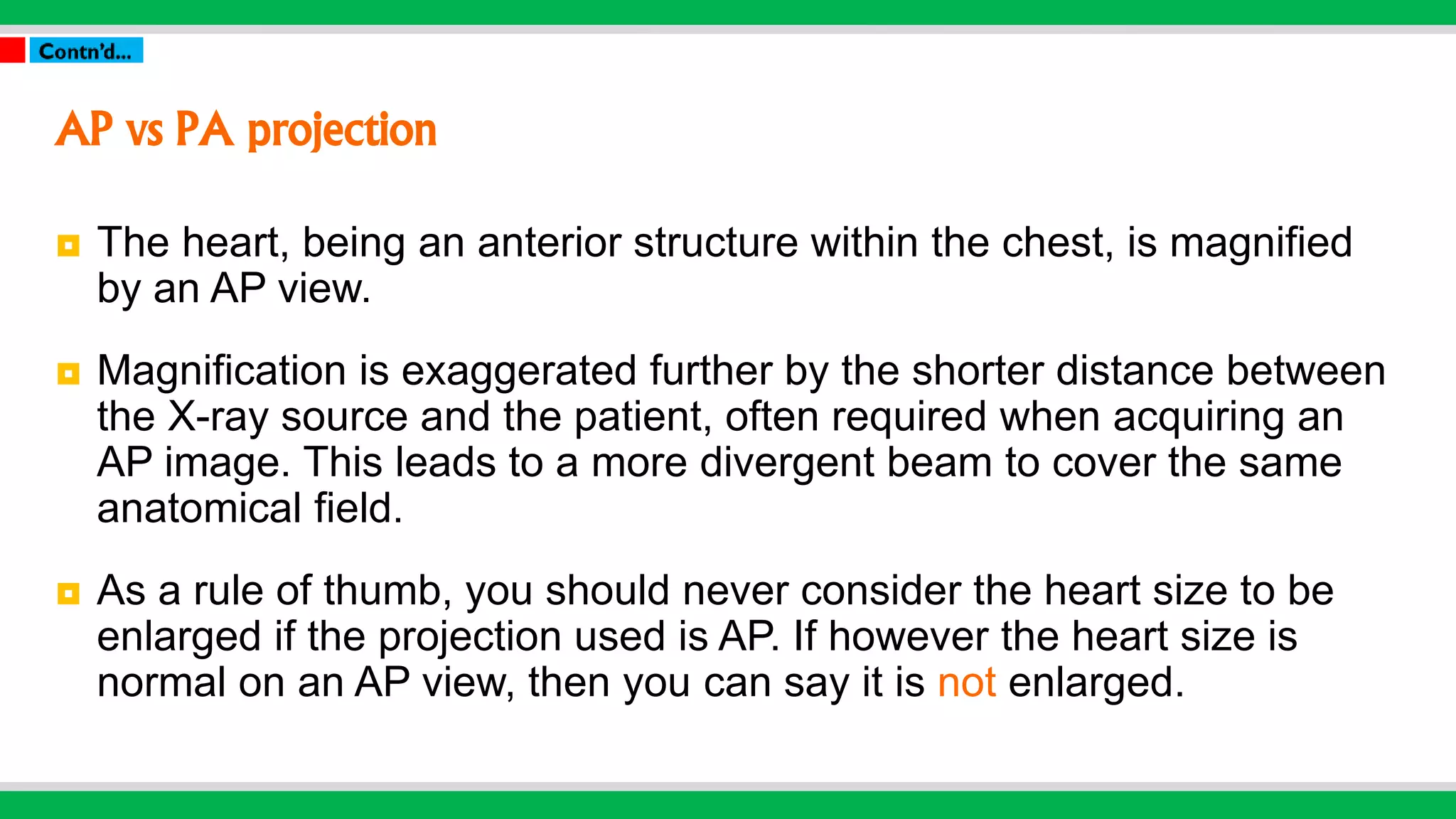 Chest X-ray: Basics | PPTX
