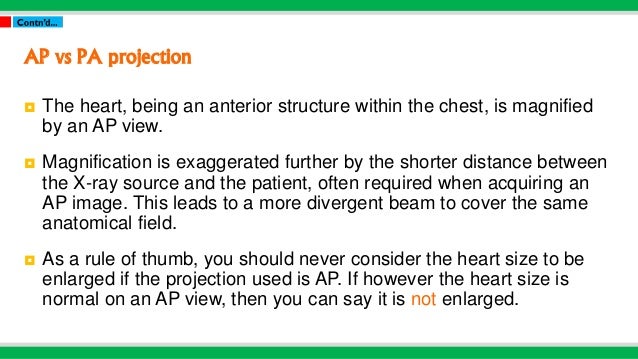 Chest X-ray: Basics