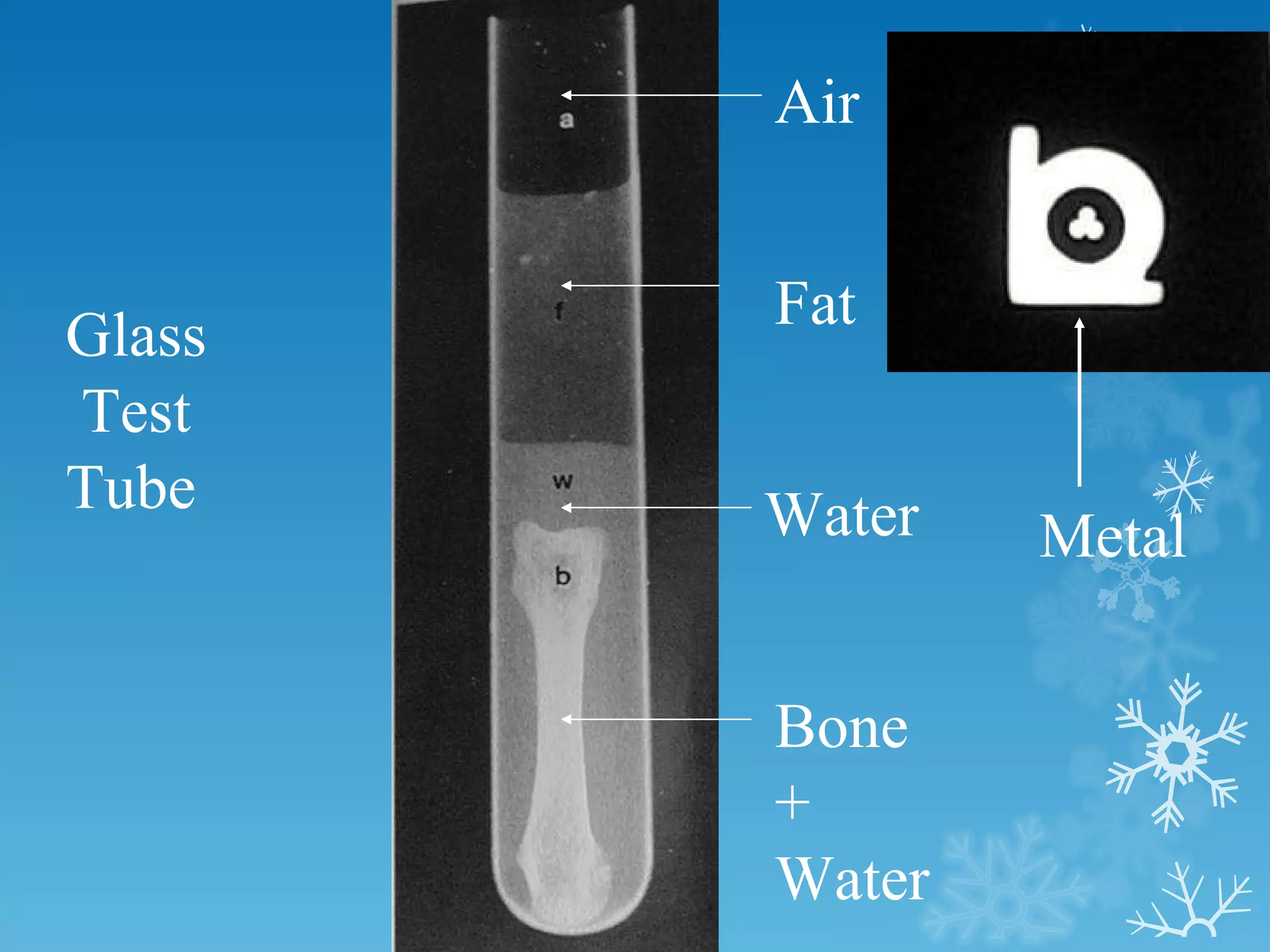 basics of chest X- ray interpretation | PPT basics of chest X- ray interpretation | PPT