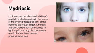 mydriasis, nystagmus, papilledema.pptx