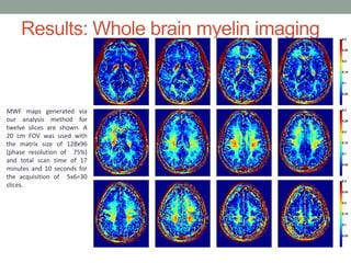 myelin presentation | PPT