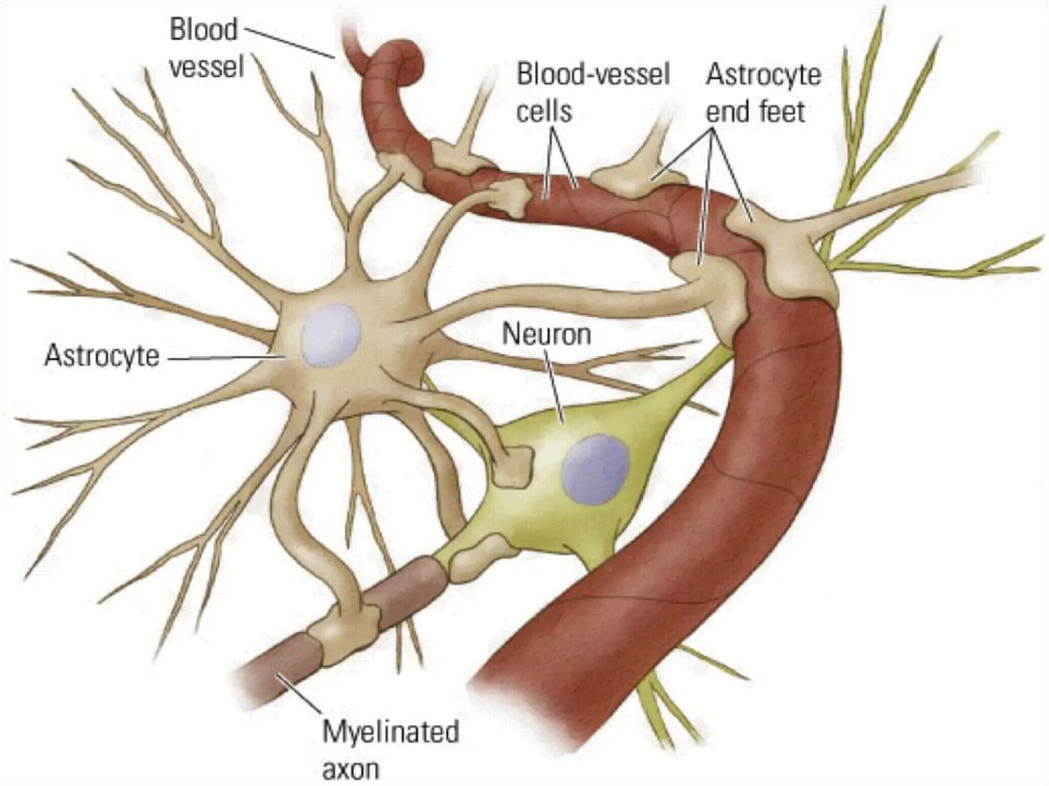 Myelin Oligodendrocyte Glycoprotein antibody associated disease (MOGAD ...