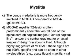 Myelin Oligodendrocyte Glycoprotein antibody associated disease (MOGAD ...