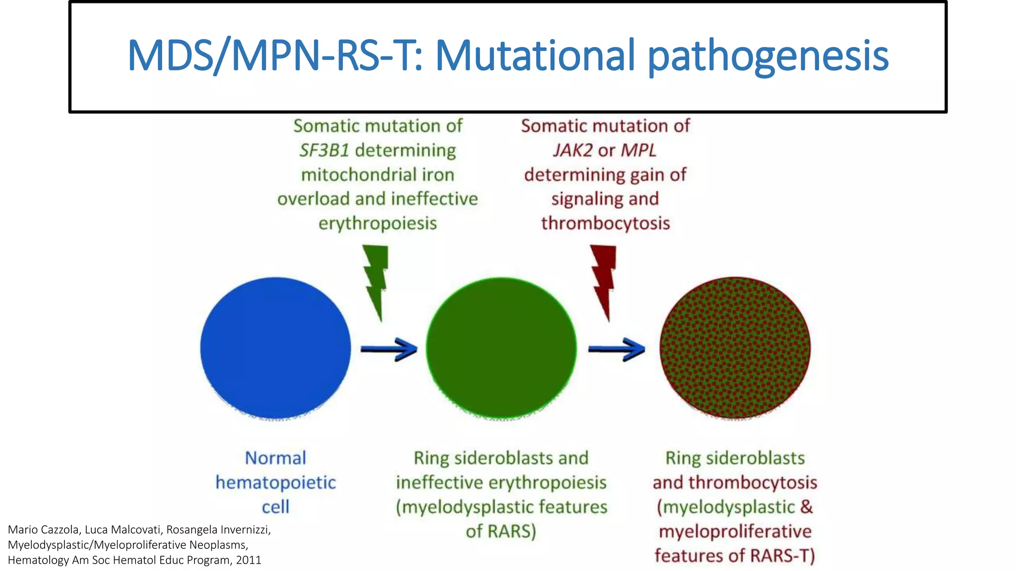 Adult Myelodysplastic/myeloproliferative neoplasms | PPTX