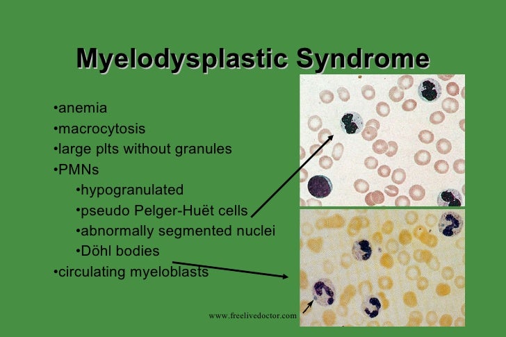 Myelodysplastic syndrome