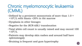 MYELODYSPLASTIC SYNDROME-3.pptx | Blood Disorders | Diseases and Conditions