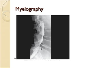 Myelogram rad 205-2011 | PPT