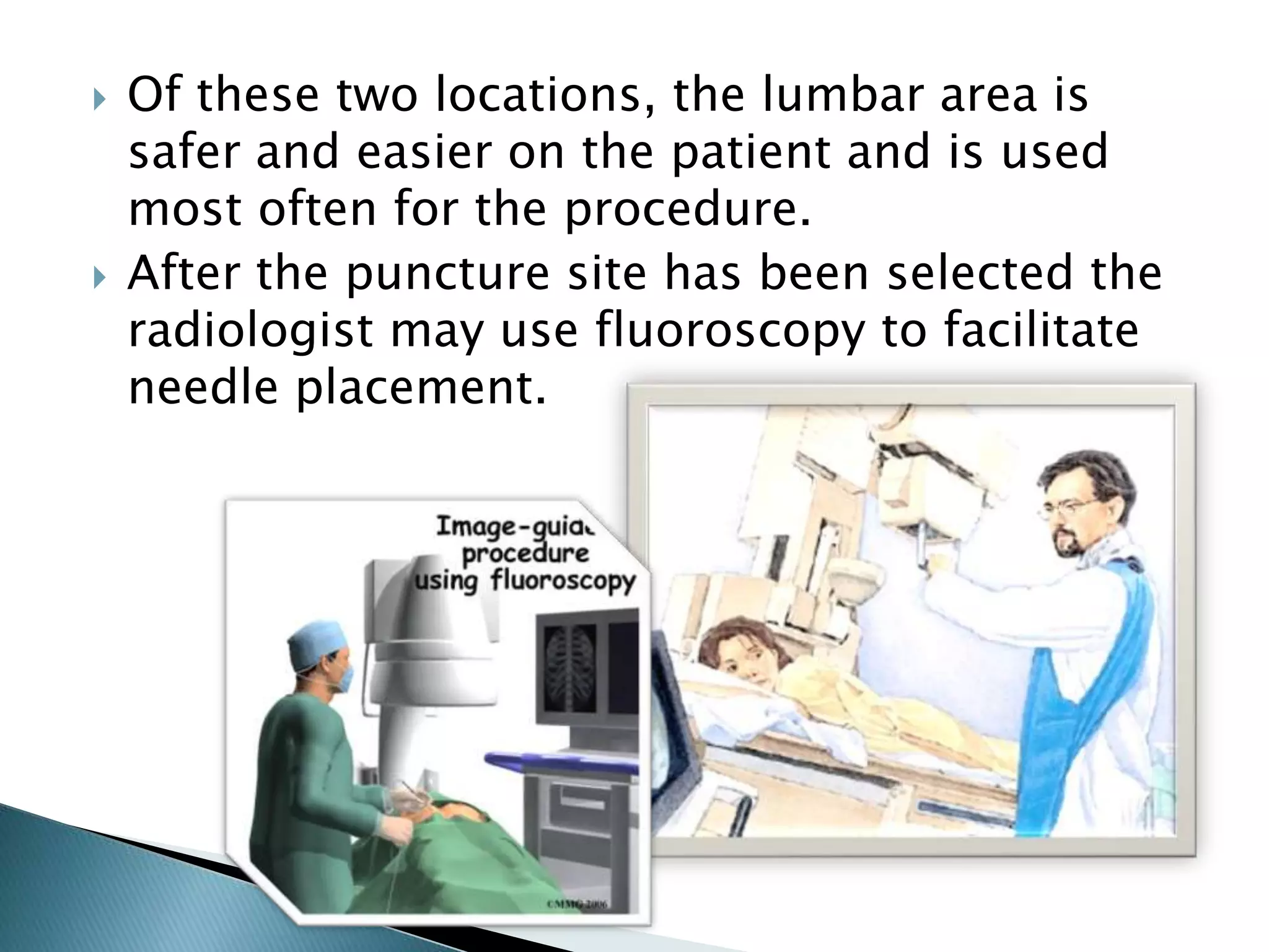Myelography | PPTX