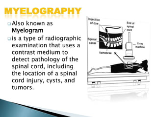 Myelography | PPTX | Brain and Nervous System Disorders | Diseases and ...