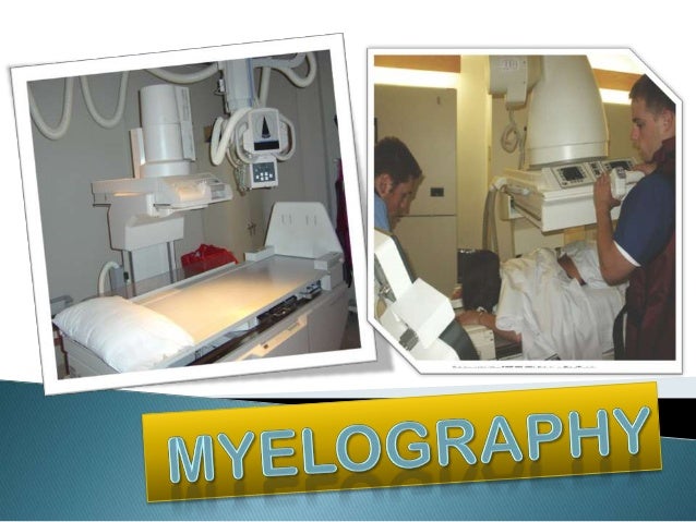 Myelography